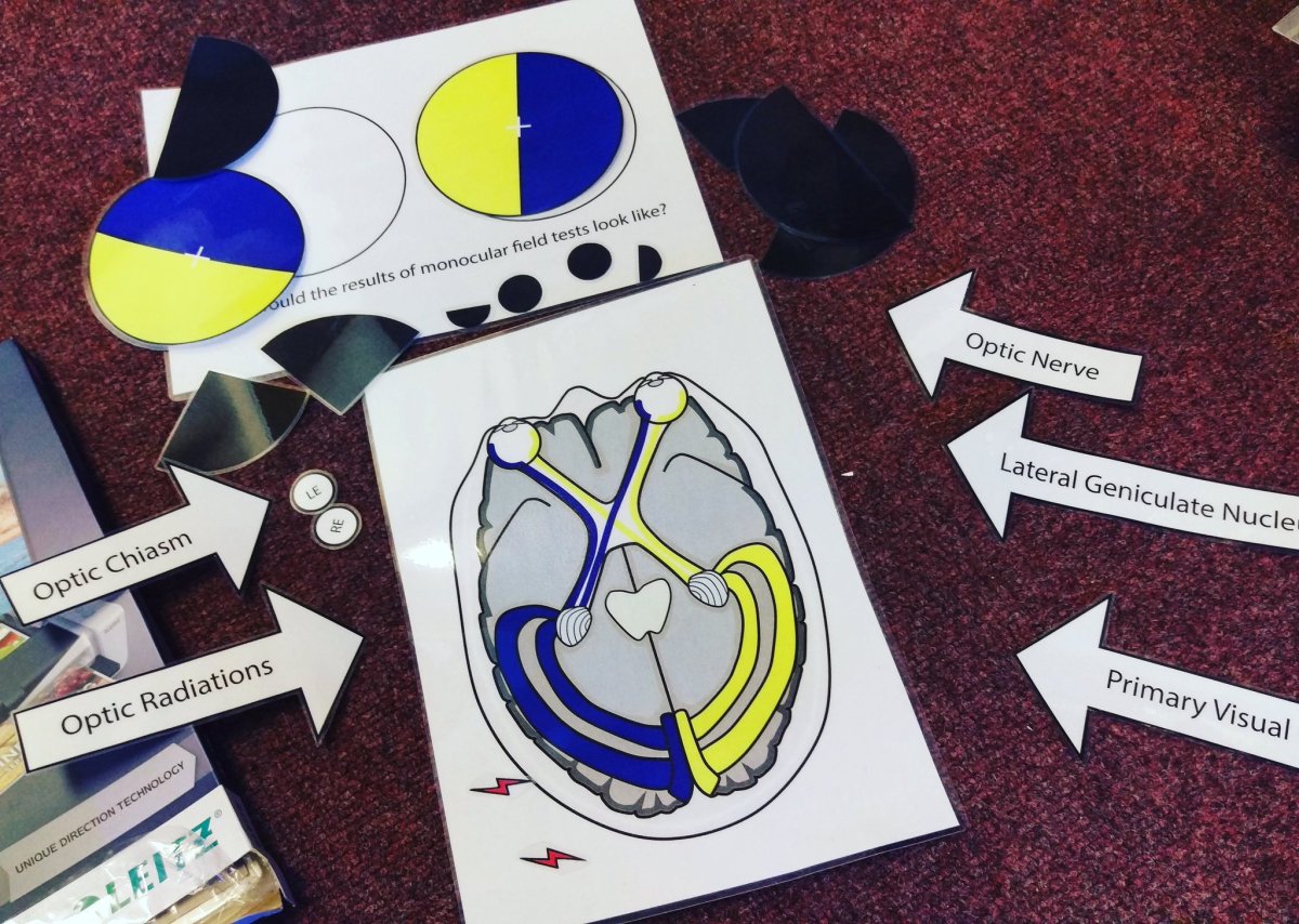 Visual Fields Activity – Sam Strong's Vision Science Pages
